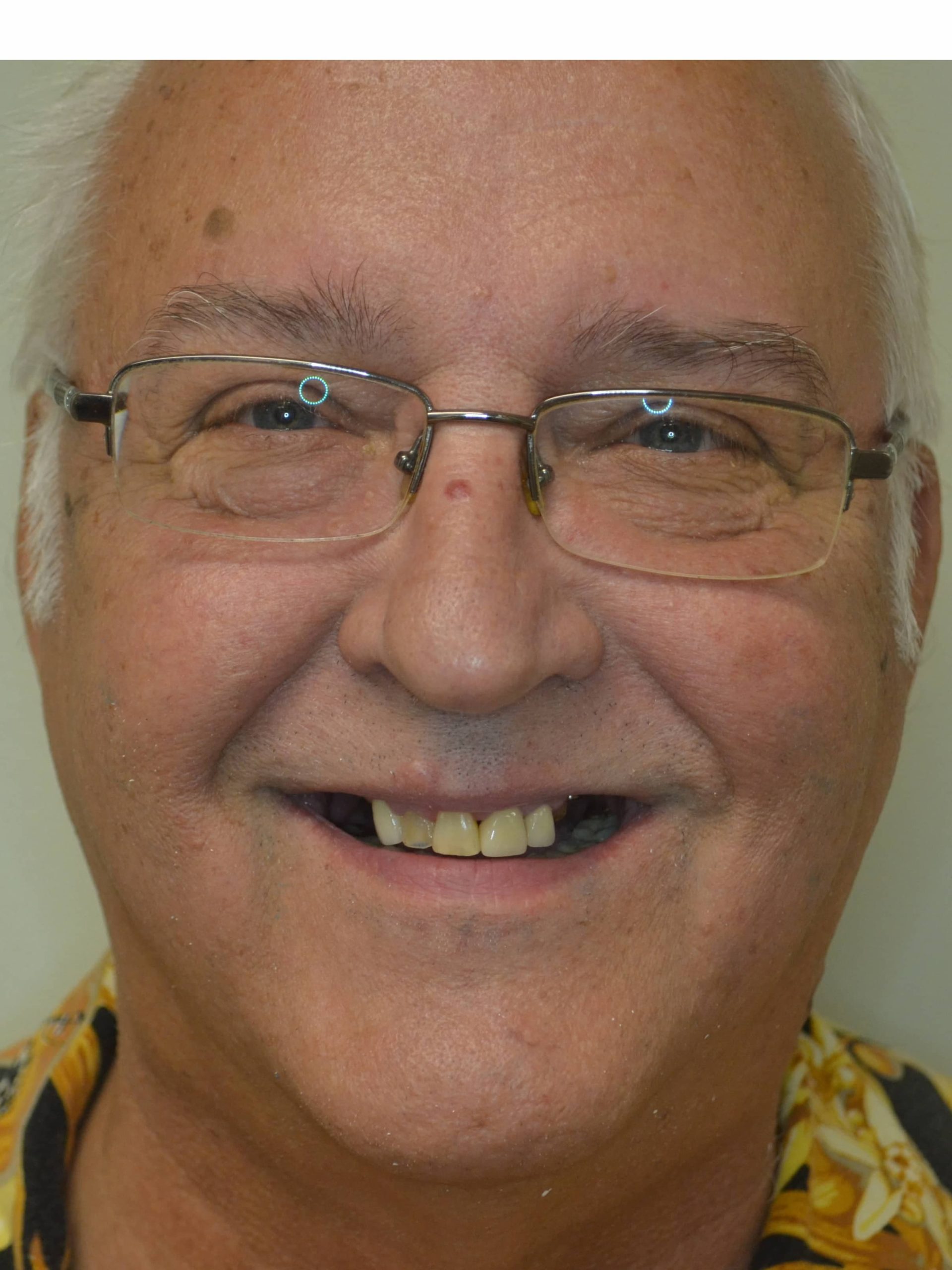 Picture Gallery | Urbana & Darby Dental Smiles