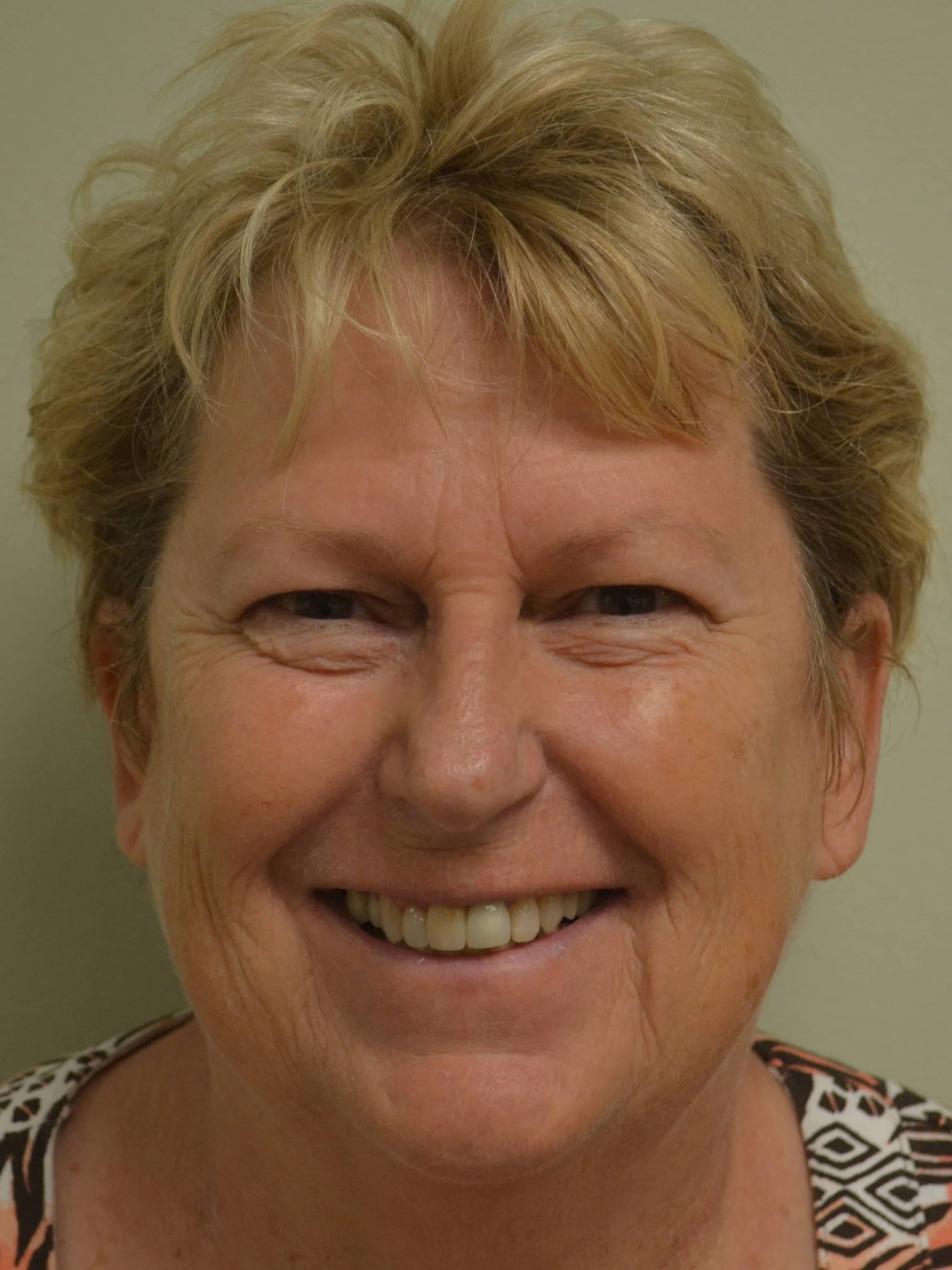 Picture Gallery | Urbana & Darby Dental Smiles